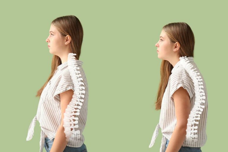 Yoga for Good Posture: Top 5 Poses for Better Alignment